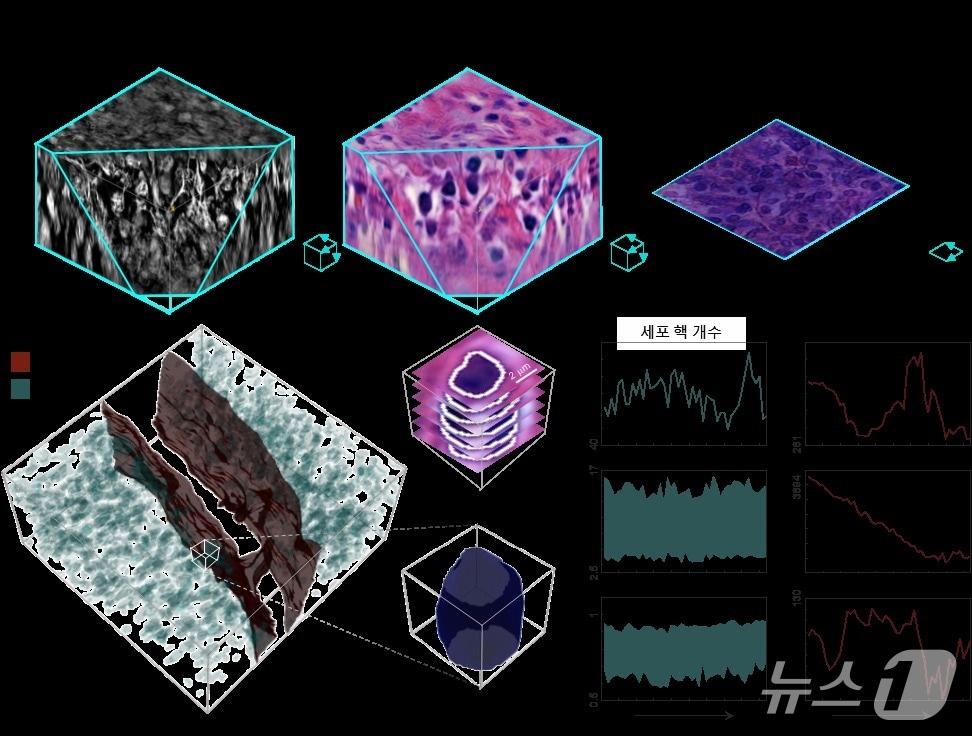 KAIST, 암 조직 '3D·가상염색'으로 관찰 기술 개발 - 뉴스1